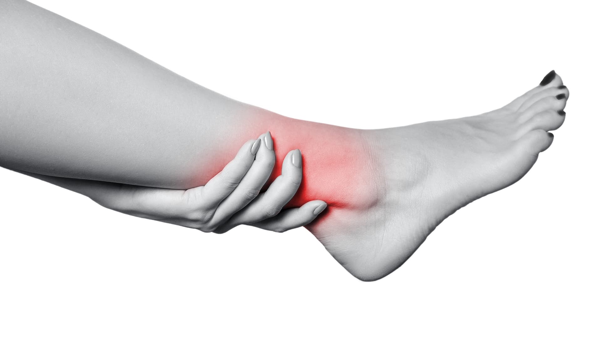 Erisipela – Dr. Bernardo Malta – Angiologia / Cirurgia Vascular e ...